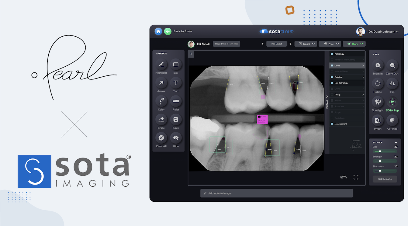 SOTA’s Dental Imaging Software Gets Pearl’s AI Pathology Detection Capabilities